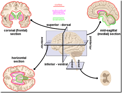 NeuroLearn: Human Brain: Directions, cross-sections and divisions